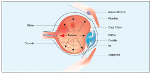 Glaucome - Centre ophtalmo à Lyon : consultations et chirurgies des yeux
